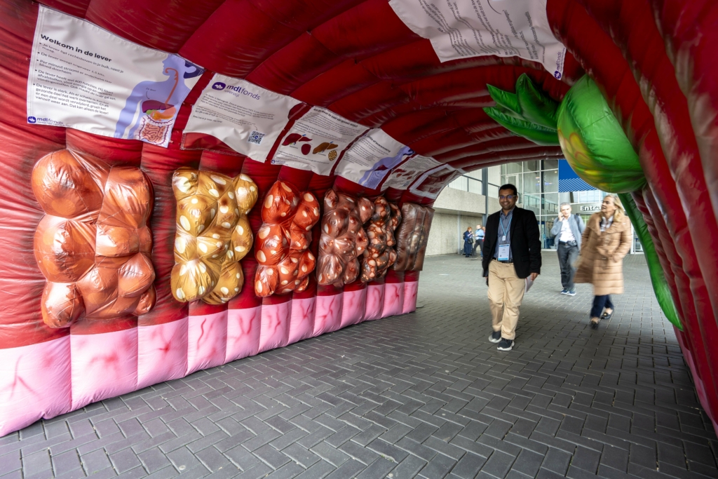 Opblaasbare lever waarschuwt voor onzichtbare leverschade | MDL Fonds